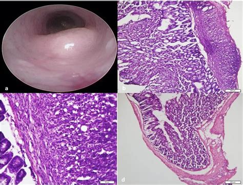 Endoscopic And Histologic Appearance Of The Rectal Tumor Model Used In