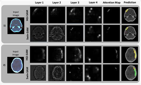Figure 3 From Weakly Supervised Intracranial Hemorrhage Segmentation