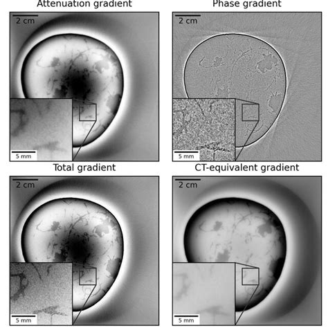 Gradient Denoising From Top To Bottom Noisy Gradients Denoised