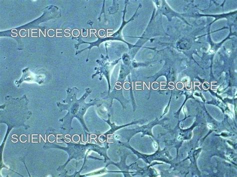 Astrocyte Nerve Cells Under A Microsco Stock Image Science Source