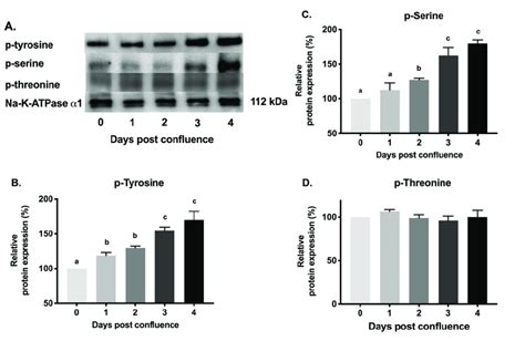 Western Blot Analysis Of Phosphorylation Levels Of Na K Atpase α1 In