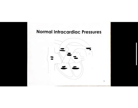 Normal Intracardiac Pressures W No Labels Quiz