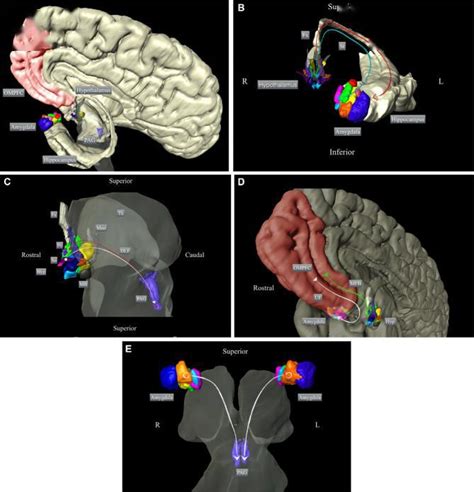 杏仁核和下丘脑在攻击行为中的作用 手术