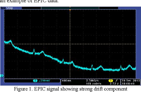 Figure 1 From Low Complexity Qrs Detectors For Performance And Energy Aware Applications