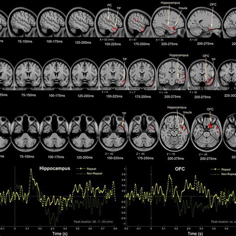Significant Hippocampalprefrontal Activation Serving Memory Retrieval