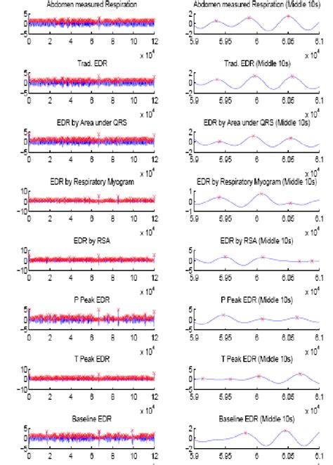 Example Of Different Ecg Derived Respiration Methods A Combination Of