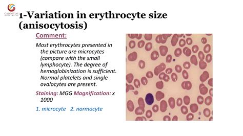 Abnormal Morphology Of Rbc Notes Pdf
