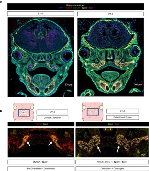 Multimodal Spatiotemporal Transcriptomic Resolution Of Embryonic Palate Osteogenesis Pmc