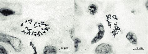 Prometaphase A And Metaphase B With Respectively Tetraploid 2n Download Scientific