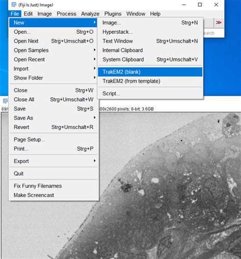 s1 step by step guide using image j in the work flow — protocols io