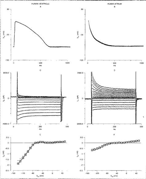 Action Potentials And Ionic Currents Recorded From Isolated Human