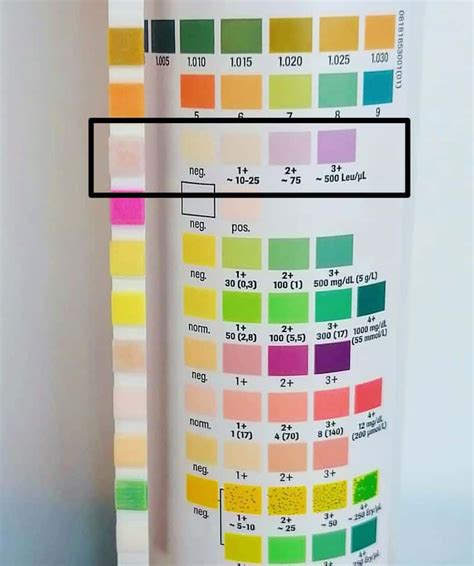 Leukocyte Esterase Testing Principle Results And Interpretation