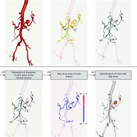 Pipeline Used For Automatic Detection Of Aneurysms Of The Visceral