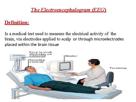 Electroencephalogram EEG Outline EEG Overview Purpose Indications Type