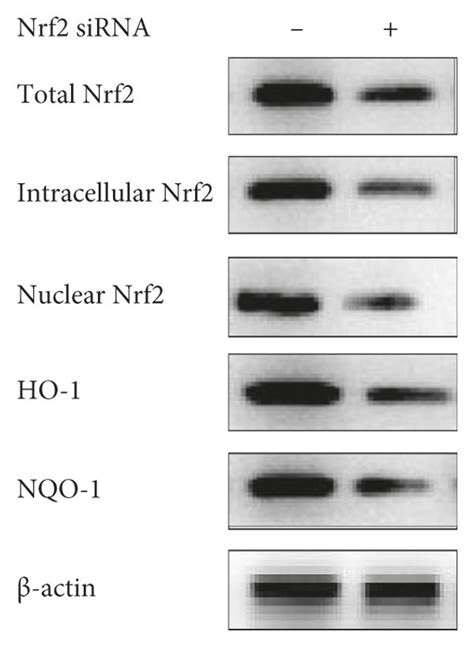 Effect Of Nrf2 Sirna On The Expression Of Nrf2 Ho 1 And Nqo 1 In Hk 2 Download Scientific