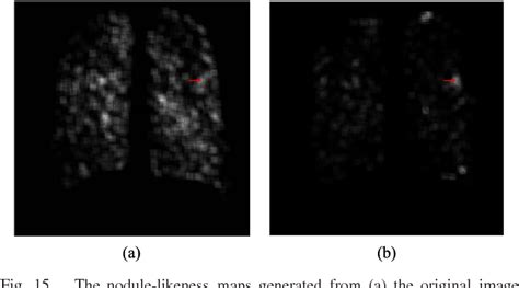 figure 15 from x ray enhancement based on component attenuation