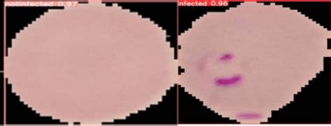 Figure 6 From A Novel Approach For Enhancing Malaria Detection Accuracy