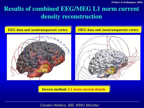 Priv Doz Dr Carsten Wolters Ppt Download