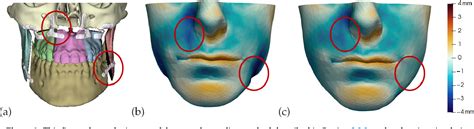 Figure 2 From Soft Tissue Simulation For Computational Planning Of