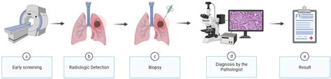 A Novel Convolutional Neural Network Algorithm For Histopathological Lung Cancer Detection