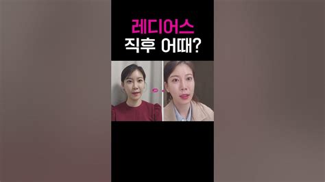 레디어스 팔자주름 해결 Skincare 피부 피부관리 시술추천 Kbeauty 스킨 피붓결 잔주름 주름
