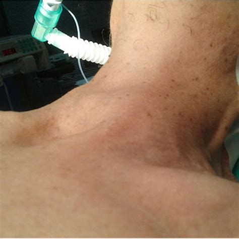 Left Cervical Solid Nodule Download Scientific Diagram