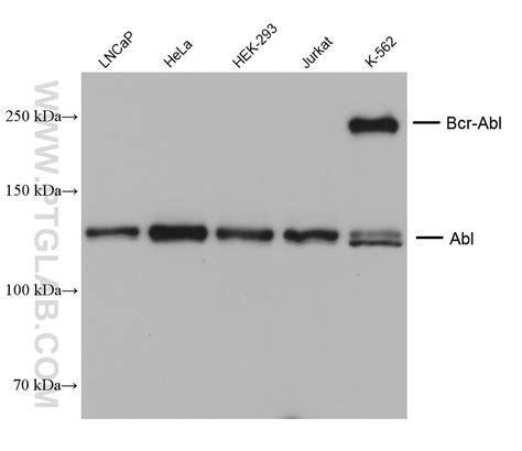 Abl1 Antibody 68254 1 Ig Proteintech