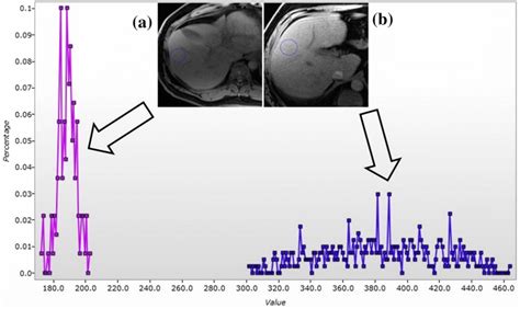 comparison of histograms of pixel intensities distribution and ta