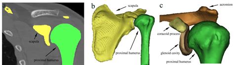 In Vivo Anatomical Research By 3d Ct Reconstruction Determines Minimum