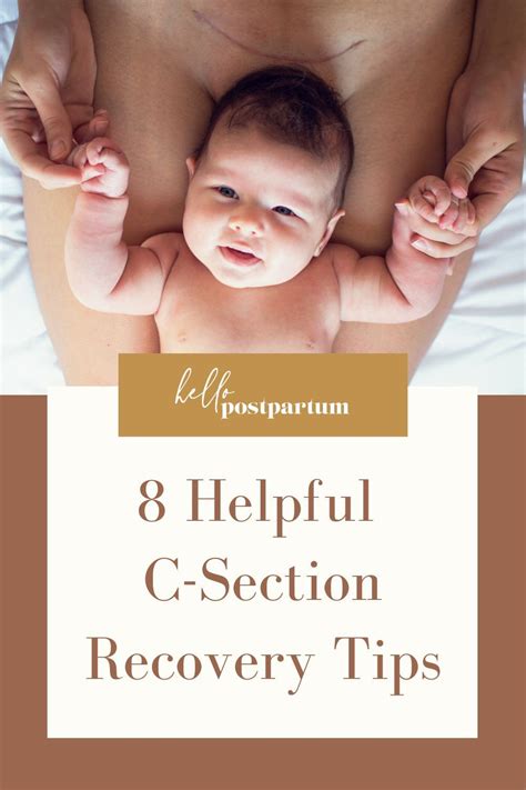 C Section Recovery Kit Ideas Self Care For The Modern Mama Artofit