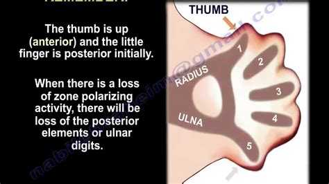Apical Ectodermal Ridge