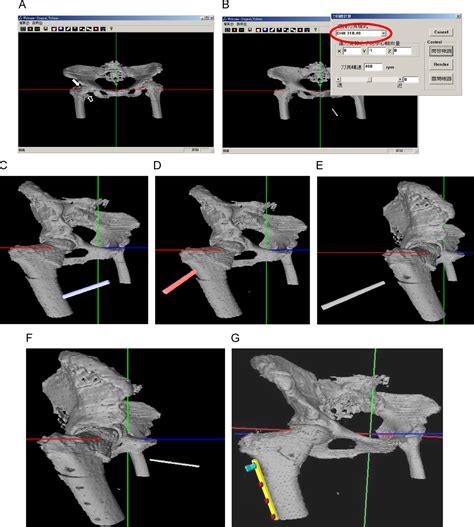 Figure 2 From Bone Drilling Haptic Interaction For Orthopedic Surgical Simulator Semantic Scholar