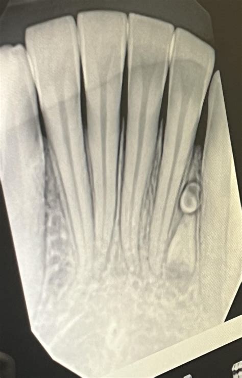 I Have An Extra Tooth R Mildlyinteresting