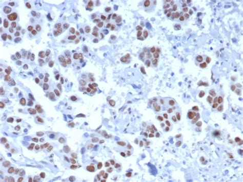 Recombinant Tle1 Synovial Sarcoma Marker Antibody Clone Tle18007r