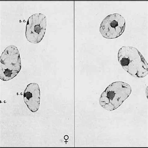 Sex Chromatin Cell Nuclei From The Foot Pad Skin Of Cats The Left Download Scientific Diagram