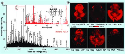 Maldi Imaging Of Formalin Fix And Paraffin Embed Tissue Section A Download Scientific