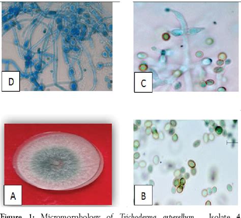 Figure 1 From Assessment Of Local Strain Of Trichoderma Asperellum Against Fusarium Spp