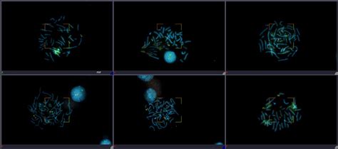 Fluorescent Metaphase