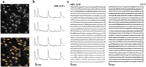 Automated Segmentation Fluorescence Trace Estimation And Spike Train Download Scientific