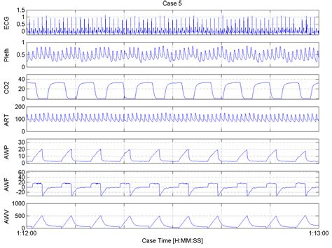 Case Waveform Plots Second Plots Case Waveform Plots Second Plots