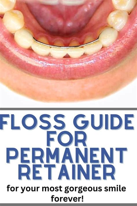 Best Floss For Permanent Retainer What Actually Works Really Well Best Floss For Permanent Retainer What Actually Works Really Well