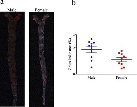 Formation Of Atherosclerotic Lesion Areas In Male And Female Apoe − − Download Scientific