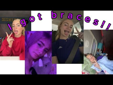 I Got Braces Night Routine Kenzie Grace YouTube