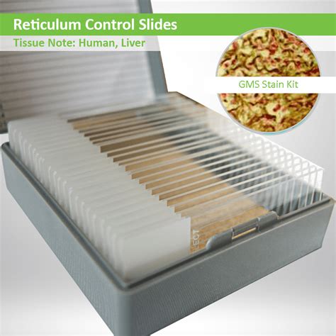 Reticulum Control Slides Imeb Inc