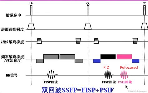 （2）医疗图像处理：mri磁共振成像 磁共振成像脉冲序列 杨正汉 mri图像处理 csdn博客