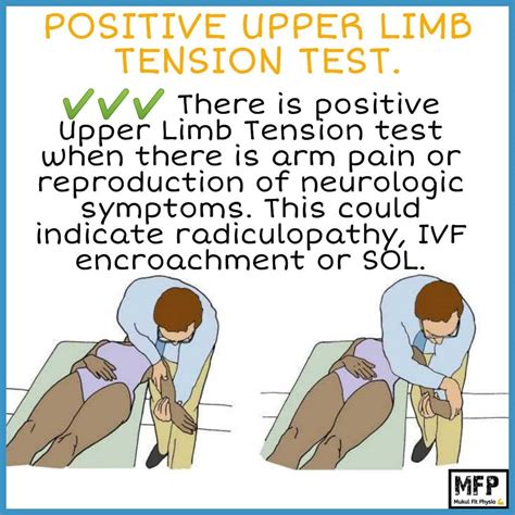 Upper Limb Tension Test