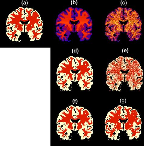 Segmentation Of Mri Data An Anatomical Model Giving True Identity Download Scientific Diagram