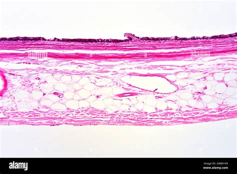 Human Gallbladder Wall Section Showing From Up To Down Simple Columnar