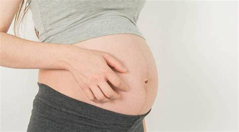 How To Treat Skin Conditions During Pregnancy According To A Doctor