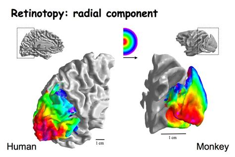 Perception Lecture Notes Cortical Visual Areas And Pathways